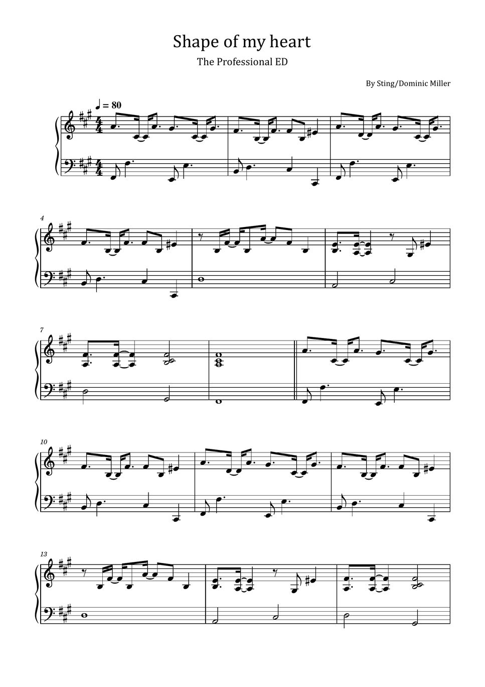 Sting/Dominic Miller - Shape Of My Heart (Sting - The Professional ED ...