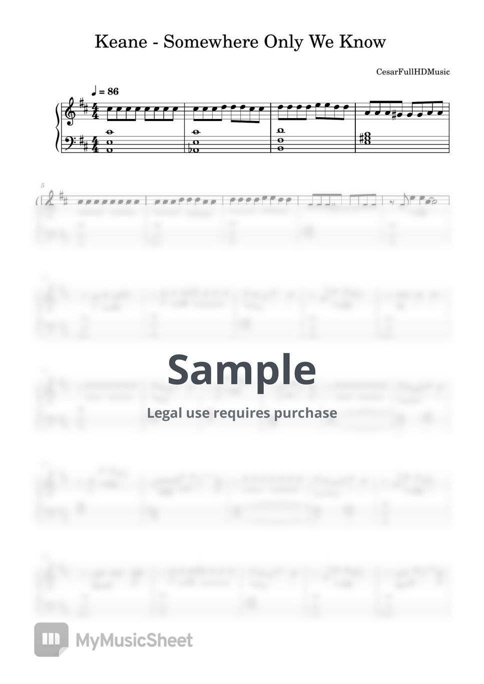 Keane - Somewhere Only We Know 악보