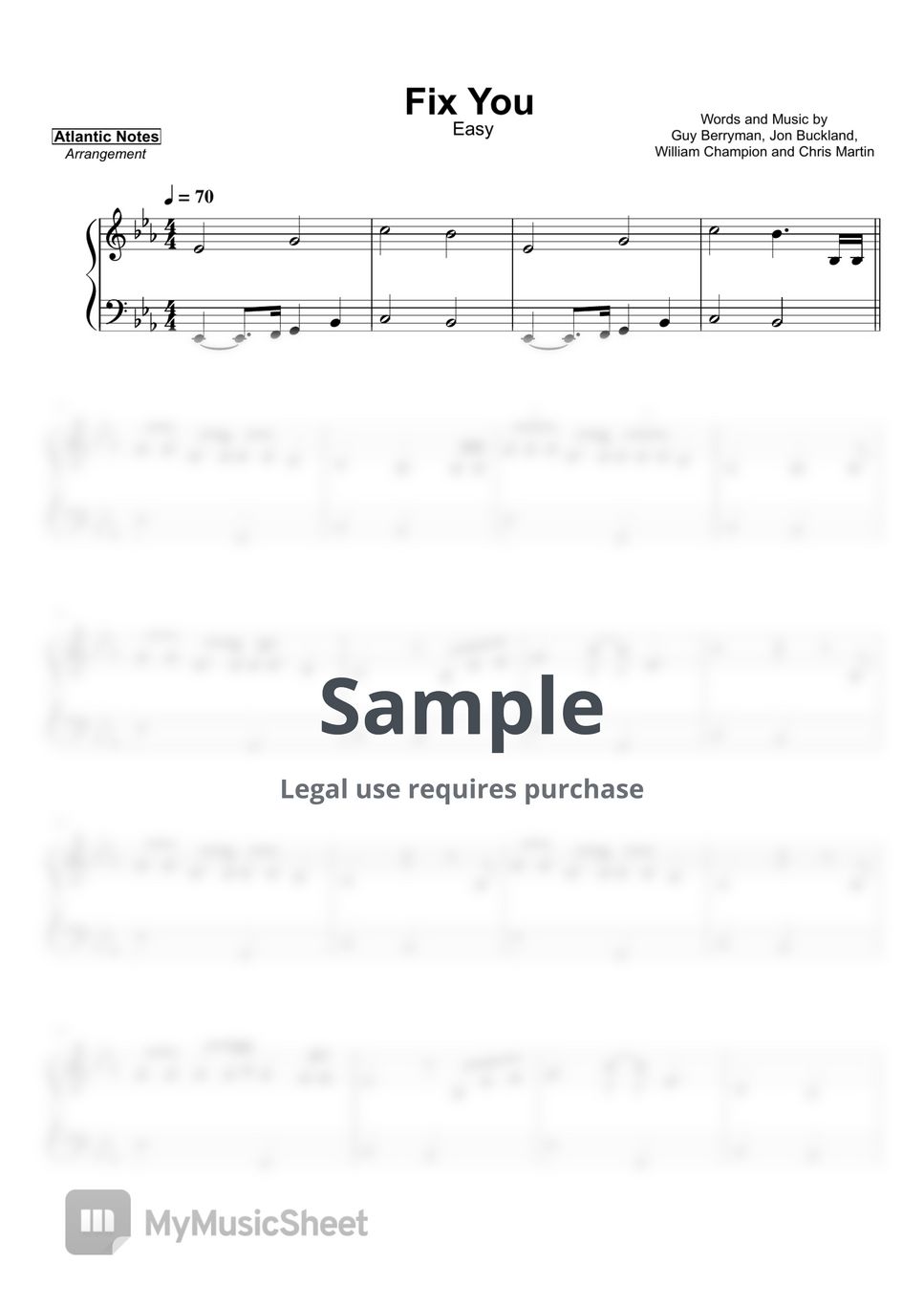 Coldplay - Fix You 악보 by Atlantic Notes