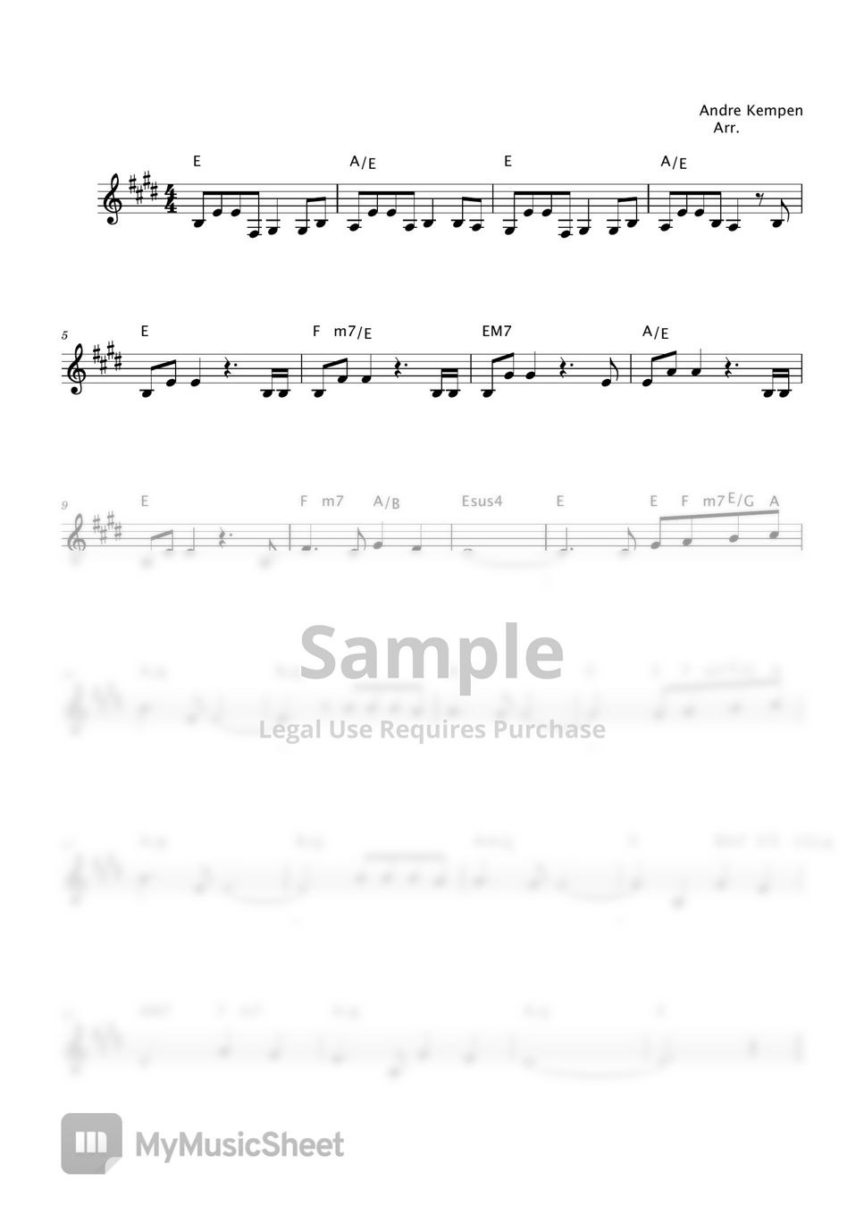 Andre Kempen 두 손 들고 찬양 합니다 G Key 멜로디악보 Sheet By 생명이건반