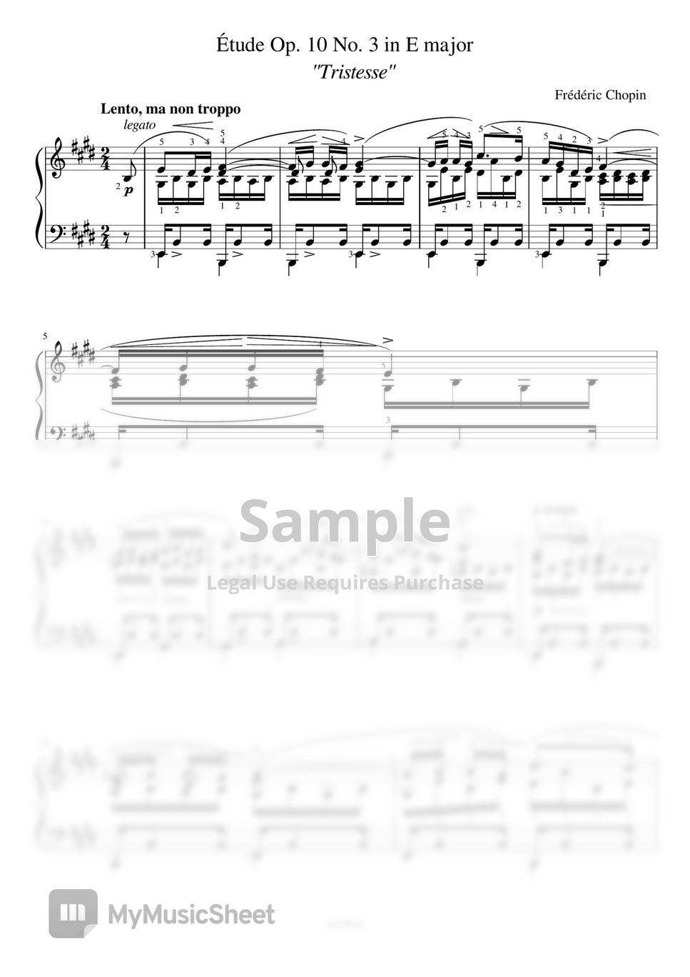 Frédéric Chopin Étude Op 10 No 3 In E Major Tristesse Original With Fingered Sheets By Poon