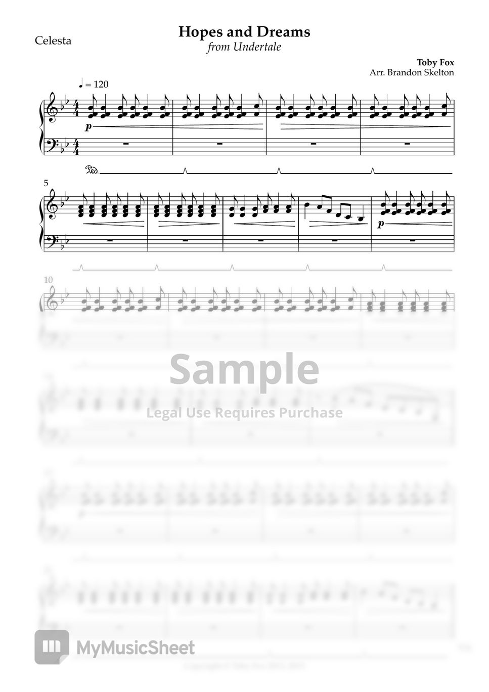 Toby Fox - Hopes and Dreams (Parts) Notenblatt by Brandon Skelton